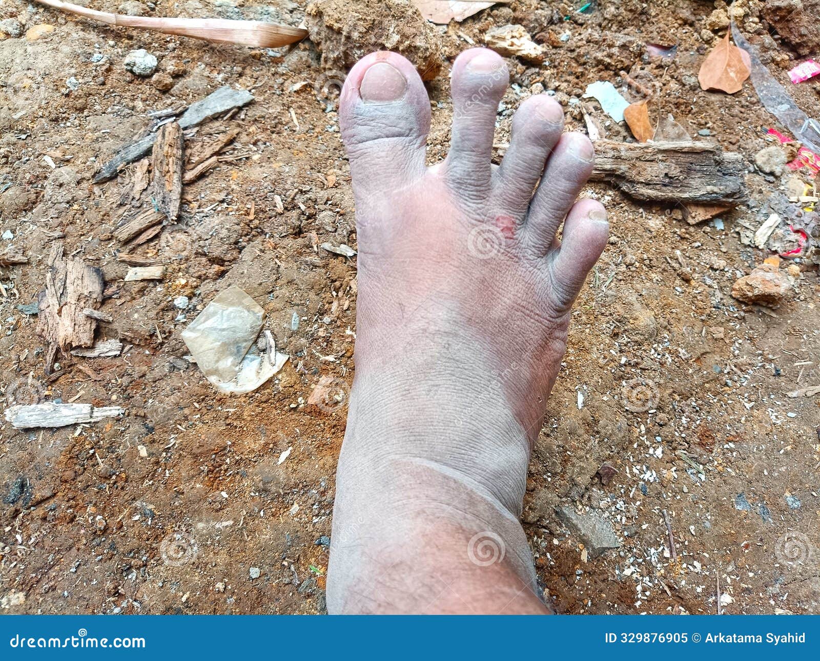 Human Feet are Dirty and Full of Dust Stock Image - Image of health ...