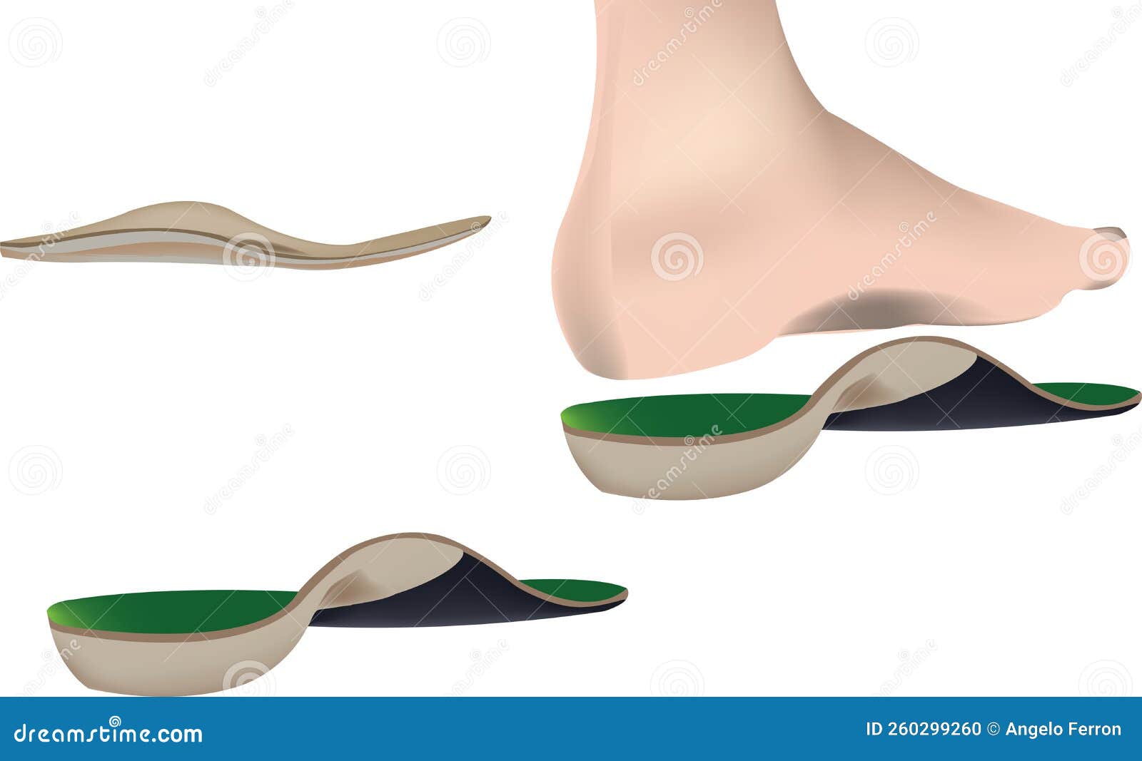 Human Feet with Use of Insoles- Stock Vector - Illustration of fitting ...