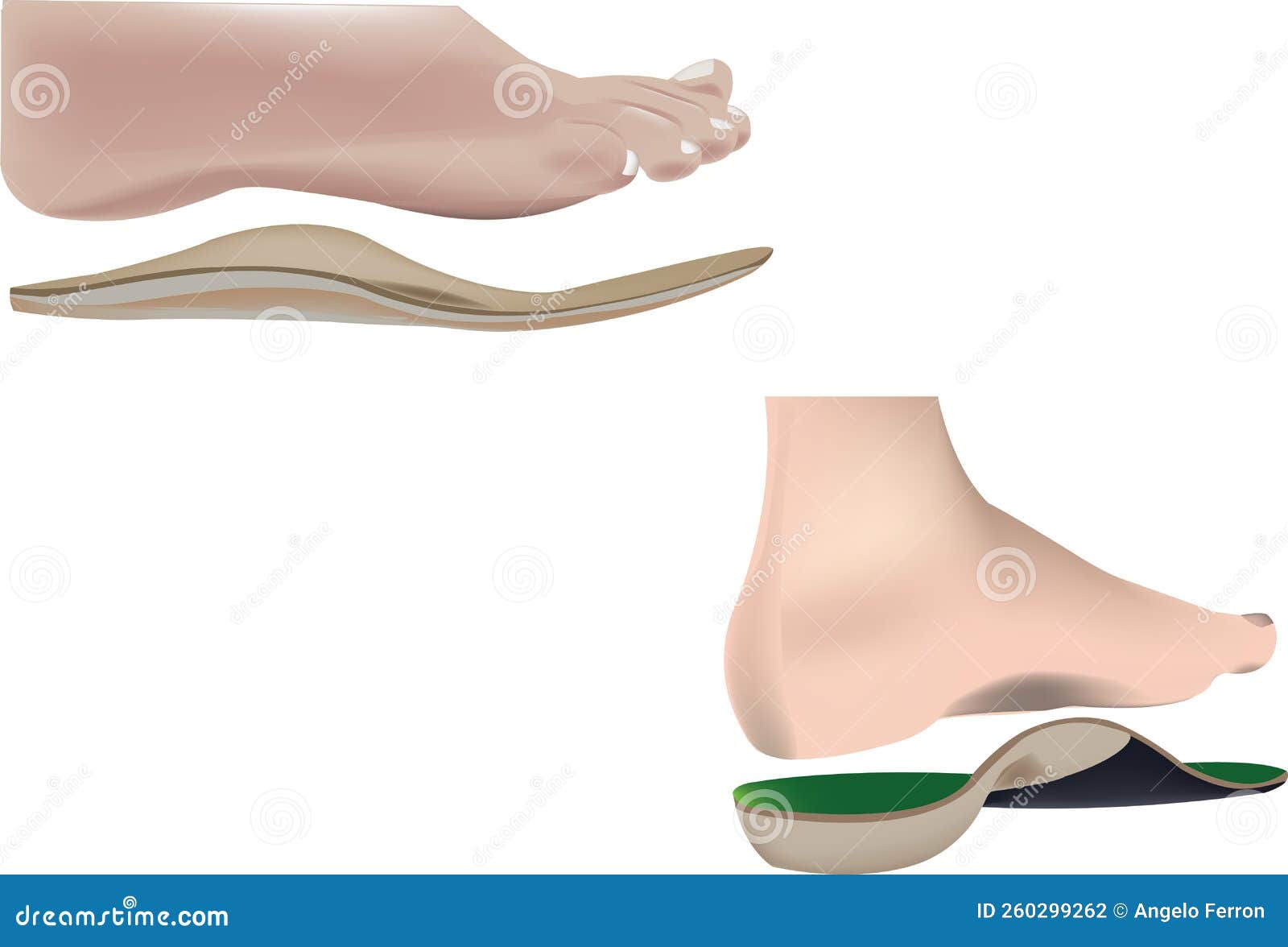 Human Feet with Use of Insoles- Stock Photo - Image of support, therapy ...