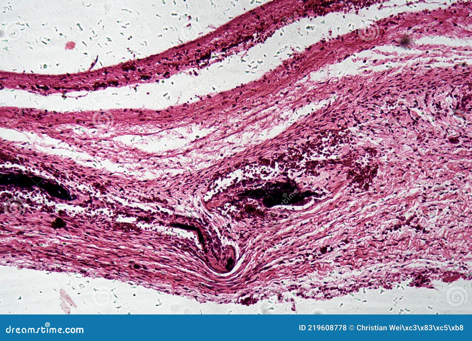 Human Fetal Head Under the Microscope Stock Photo - Image of care ...