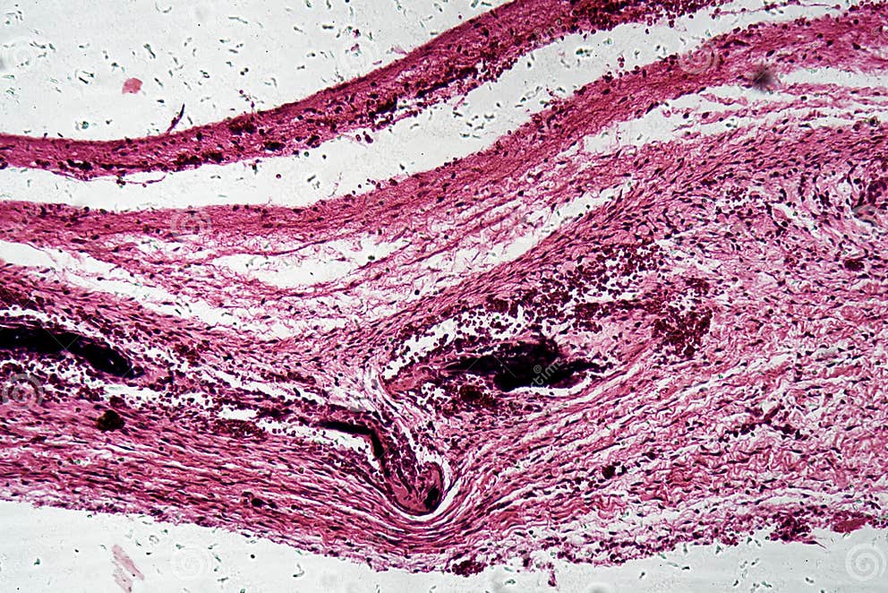 Human Fetal Head Under the Microscope Stock Photo - Image of care ...