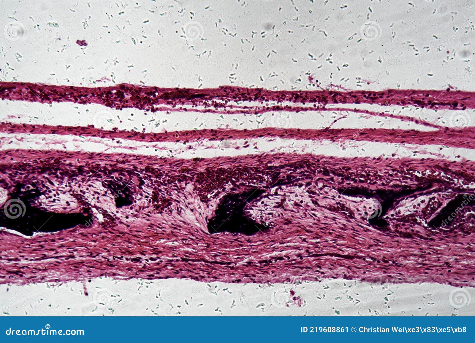 Human Fetal Head Under the Microscope Stock Image - Image of compact ...