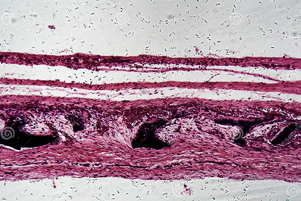 Human Fetal Head Under the Microscope Stock Image - Image of compact ...