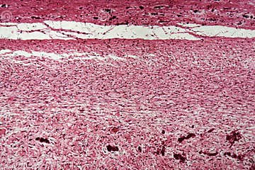 Human Fetal Head Under the Microscope Stock Image - Image of anatomy ...