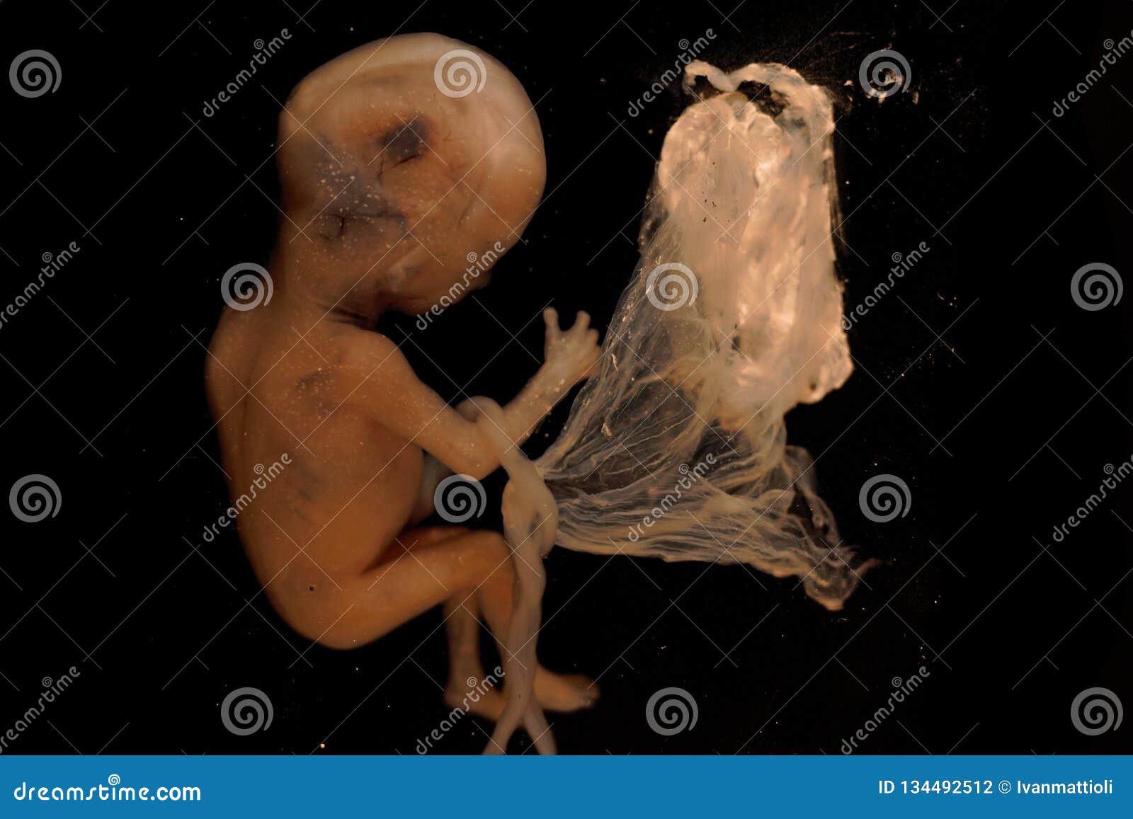 Real Human Fetus