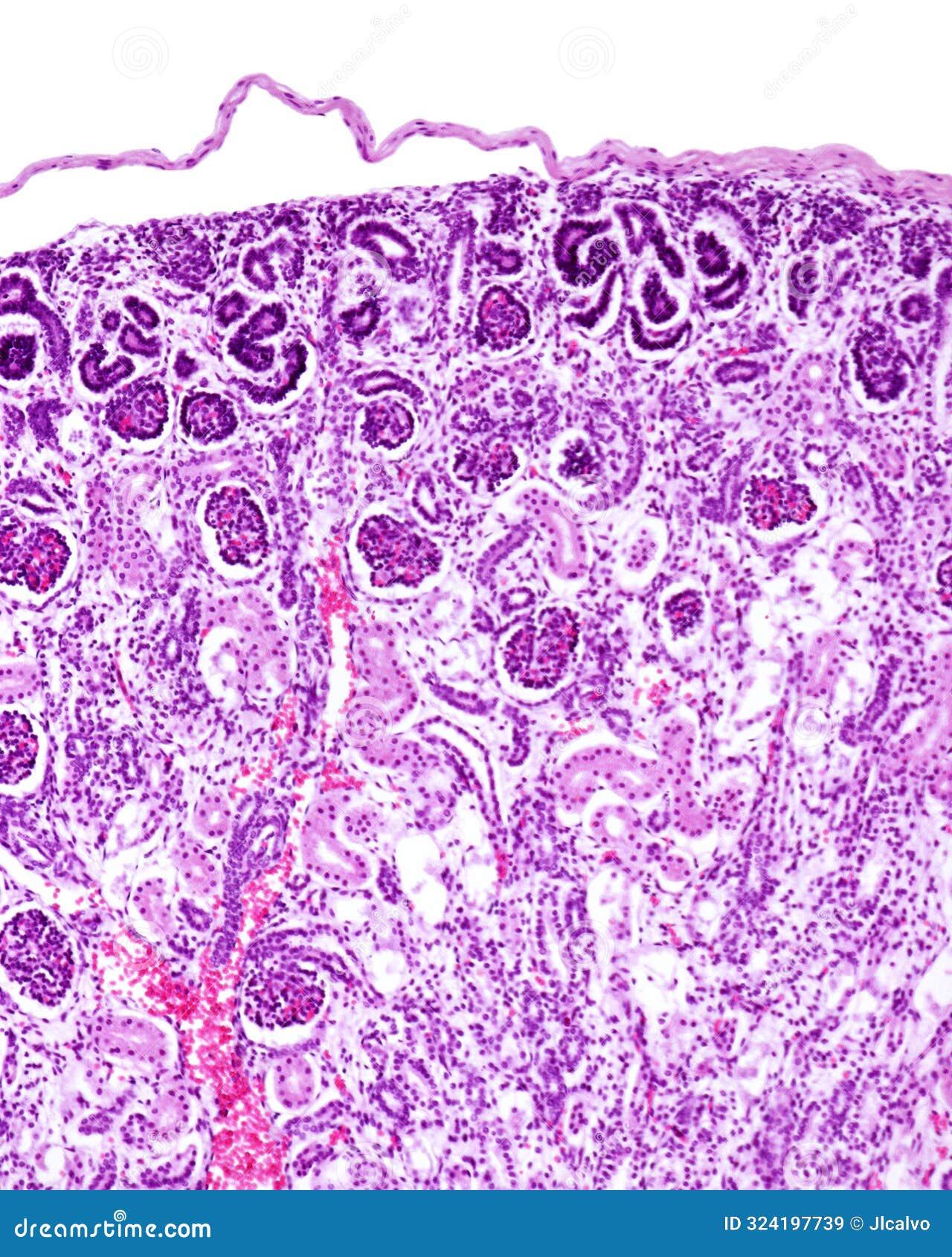 Human Foetal Kidney. Glomerulus Development Stock Image - Image of ...