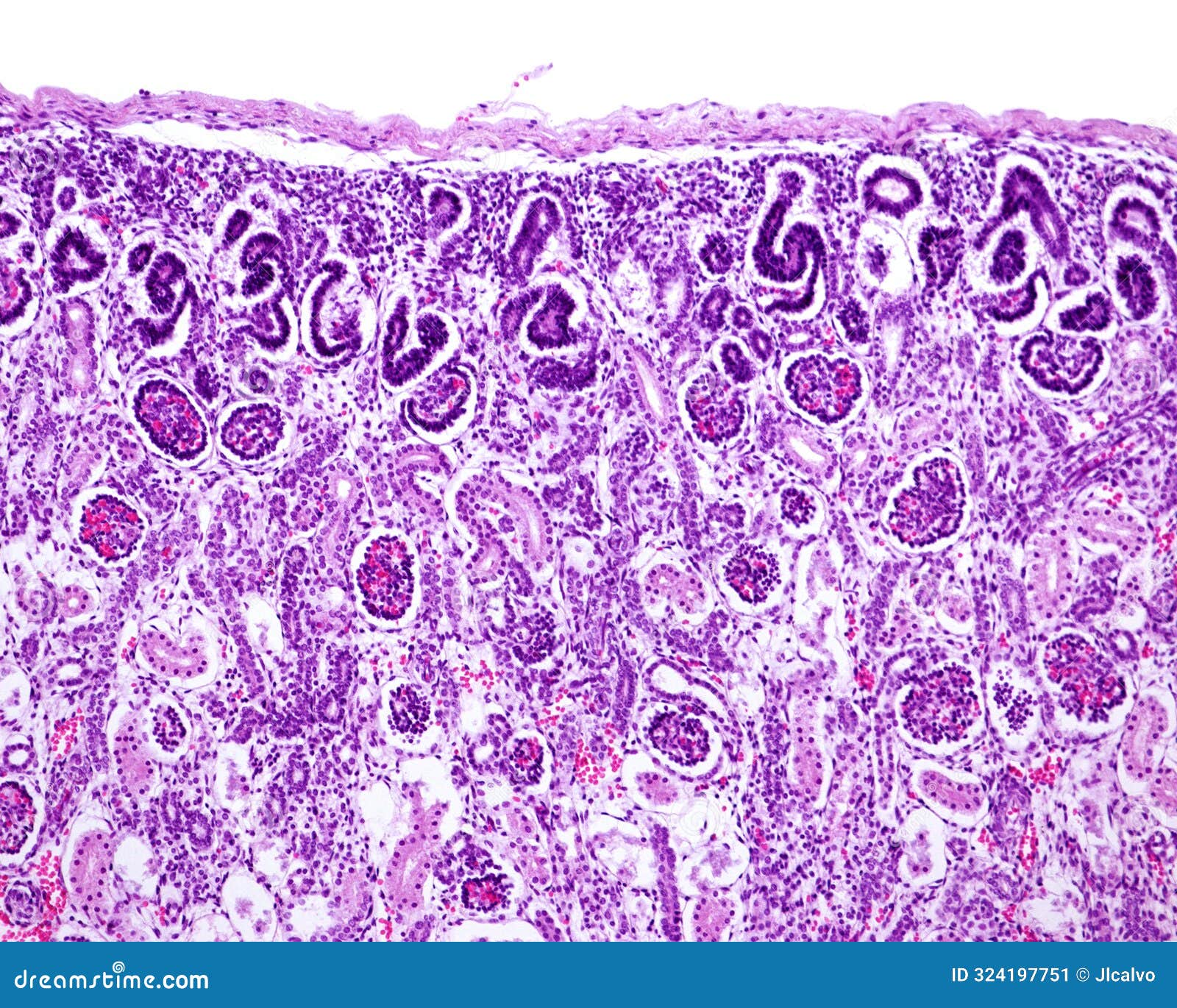 Human Foetal Kidney. Glomerulus Development Stock Image - Image of ...
