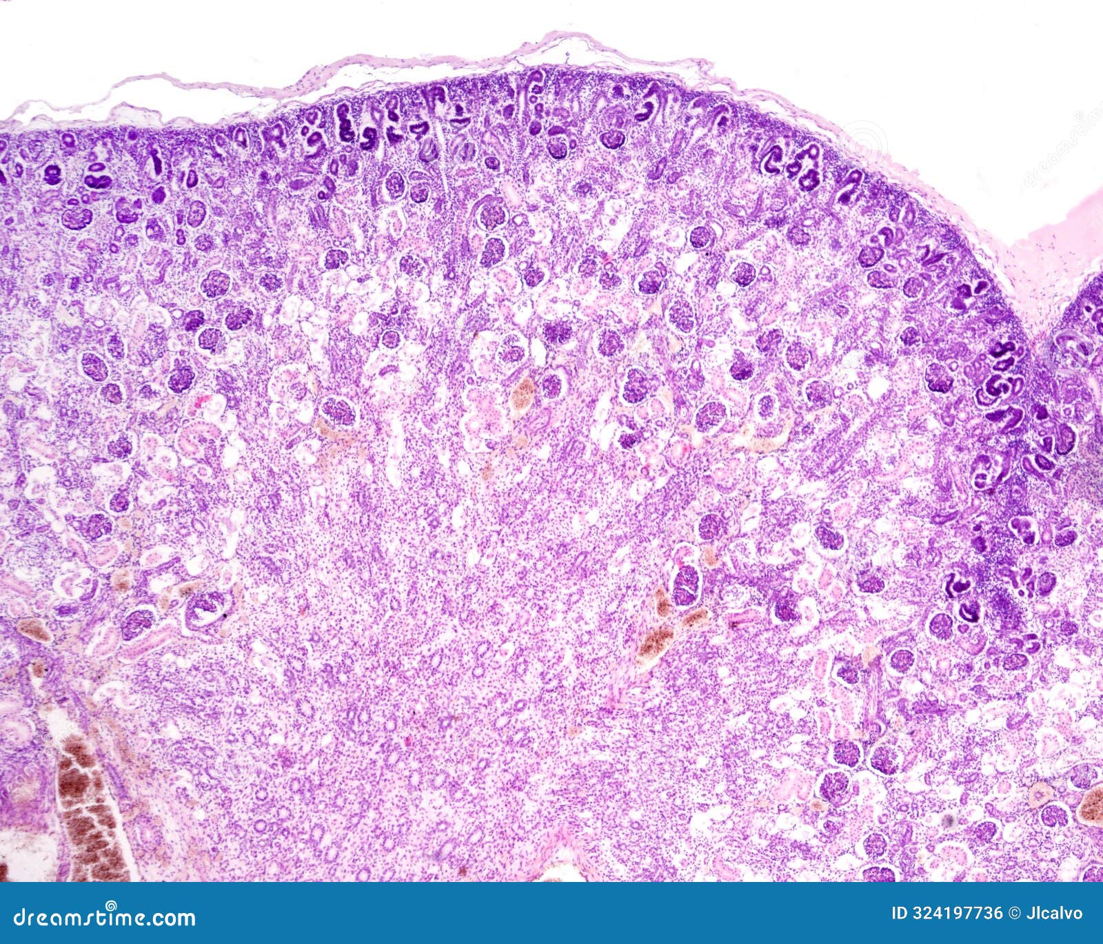 Human foetal kidney stock photo. Image of kidney, development - 324197736