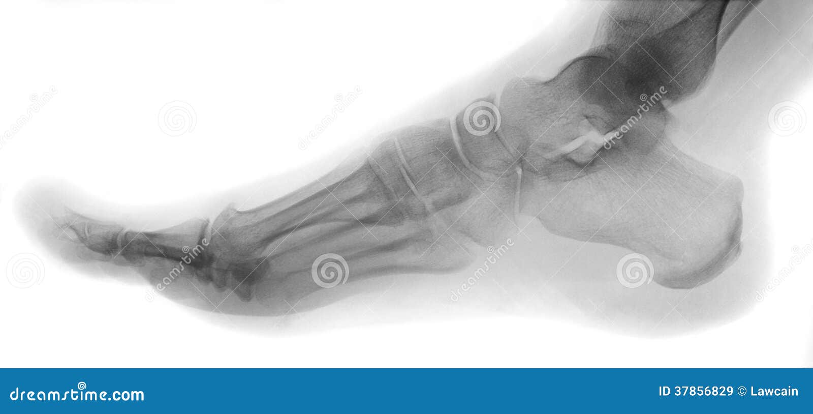 Human Foot stock image. Image of care, side, orthopedic - 37856829