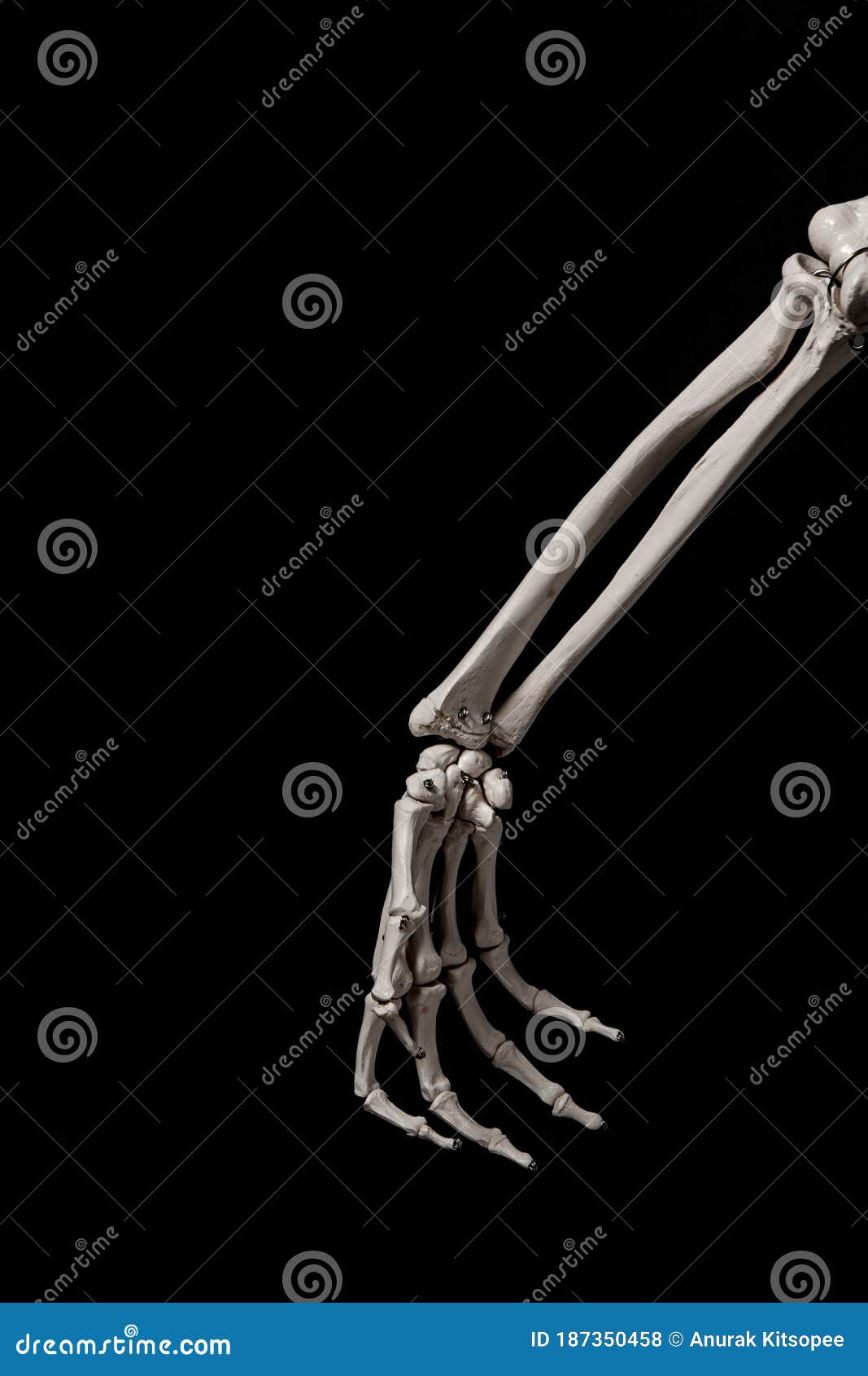 Human Forearm With Wounds From A Dog Bite Royalty-Free Stock Image ...