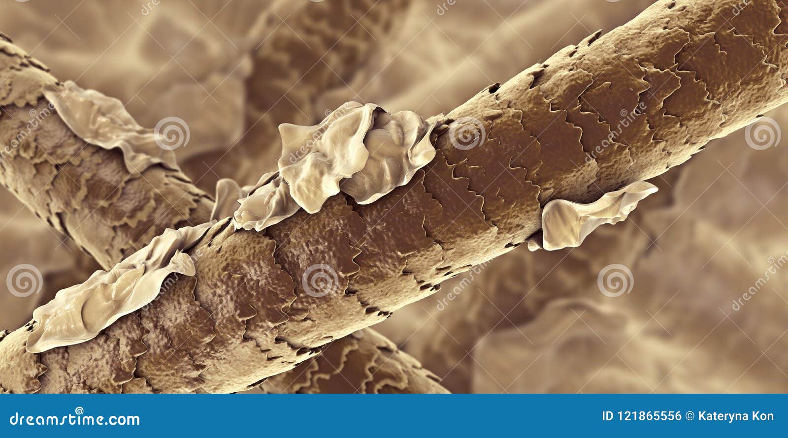 Dandruff Flake Under Microscope