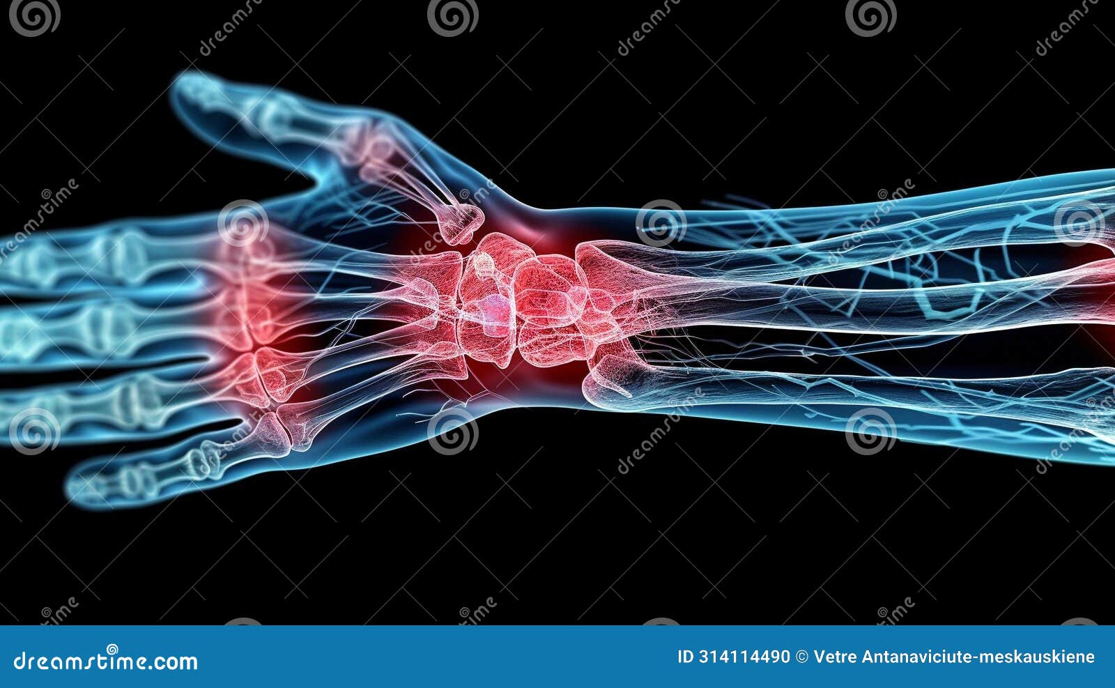 Human Hand Anatomy X-ray Visualization Stock Photo - Image of biology ...