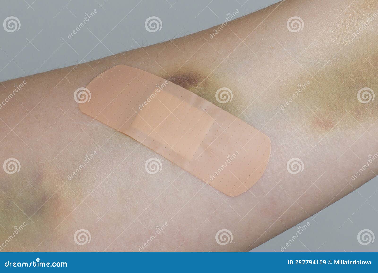 Human Hand with a Band Aid Closeup Stock Image - Image of injury ...