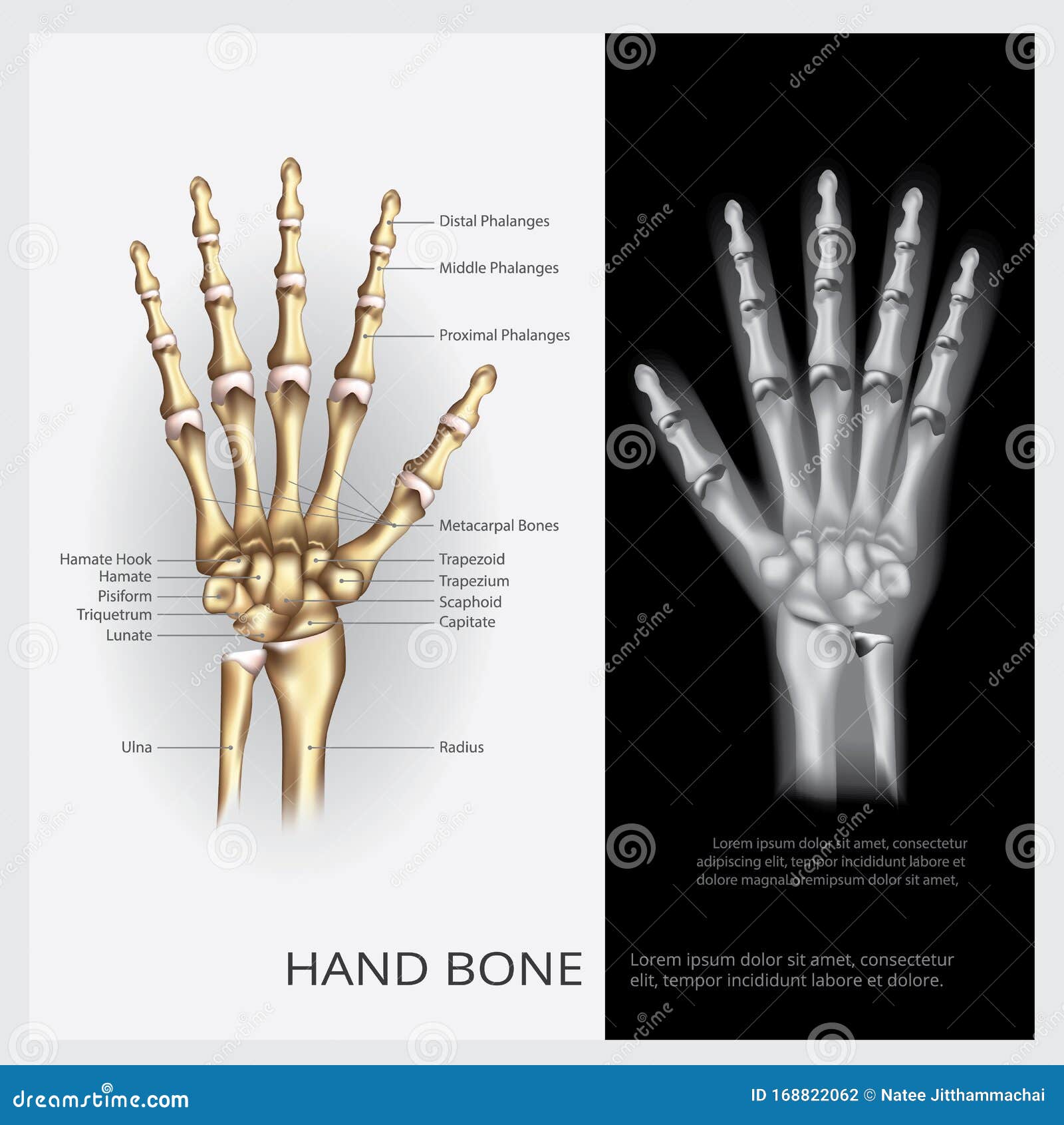 Human Hand Bone Vector Illustration Stock Vector - Illustration of ...