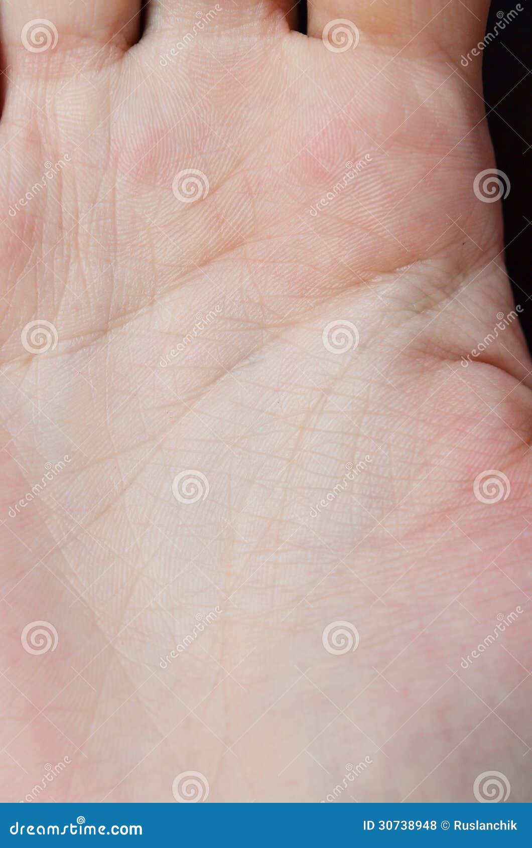Human hand stock photo. Image of skin, person, dermatology - 30738948
