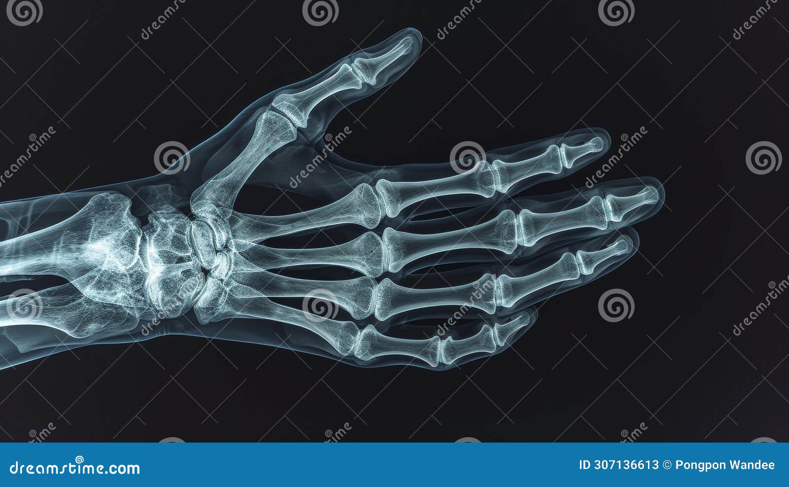 Human Hand X-Ray Showing Bone Structure and Anatomy Stock Illustration ...
