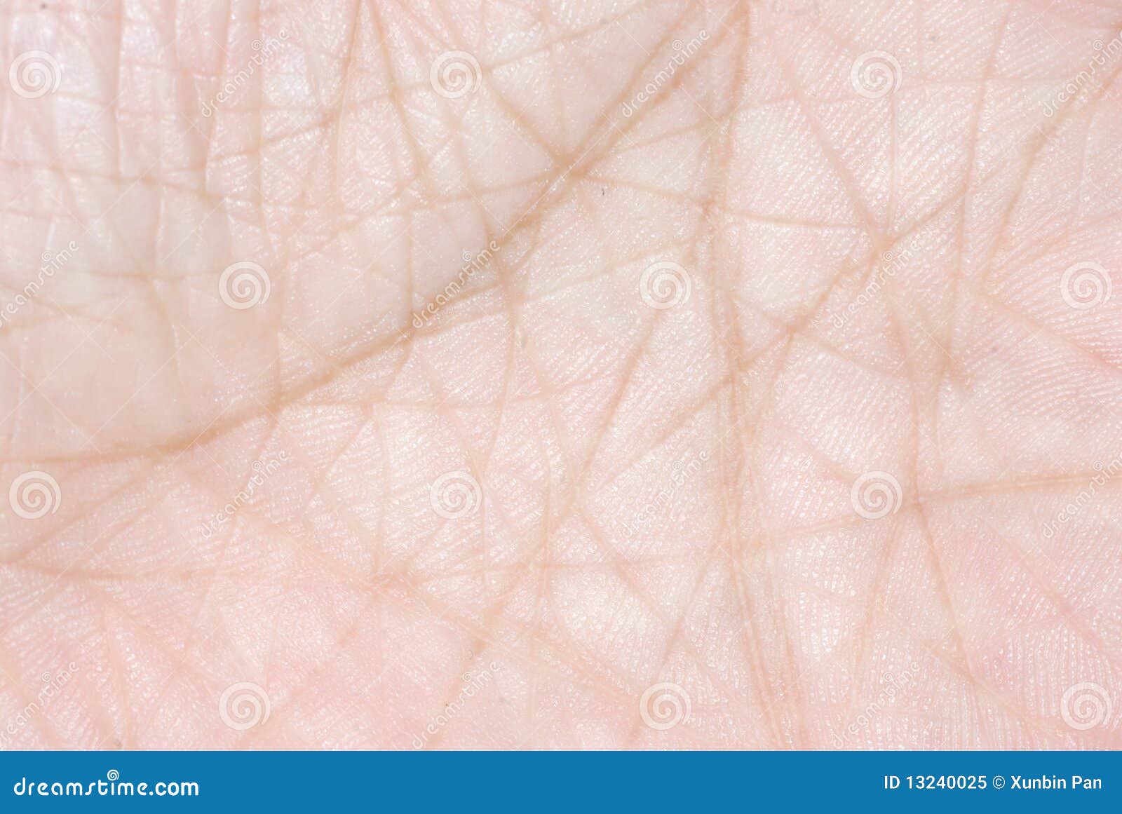 Human Hand Skin Royalty Free Stock Photo - Image: 13240025