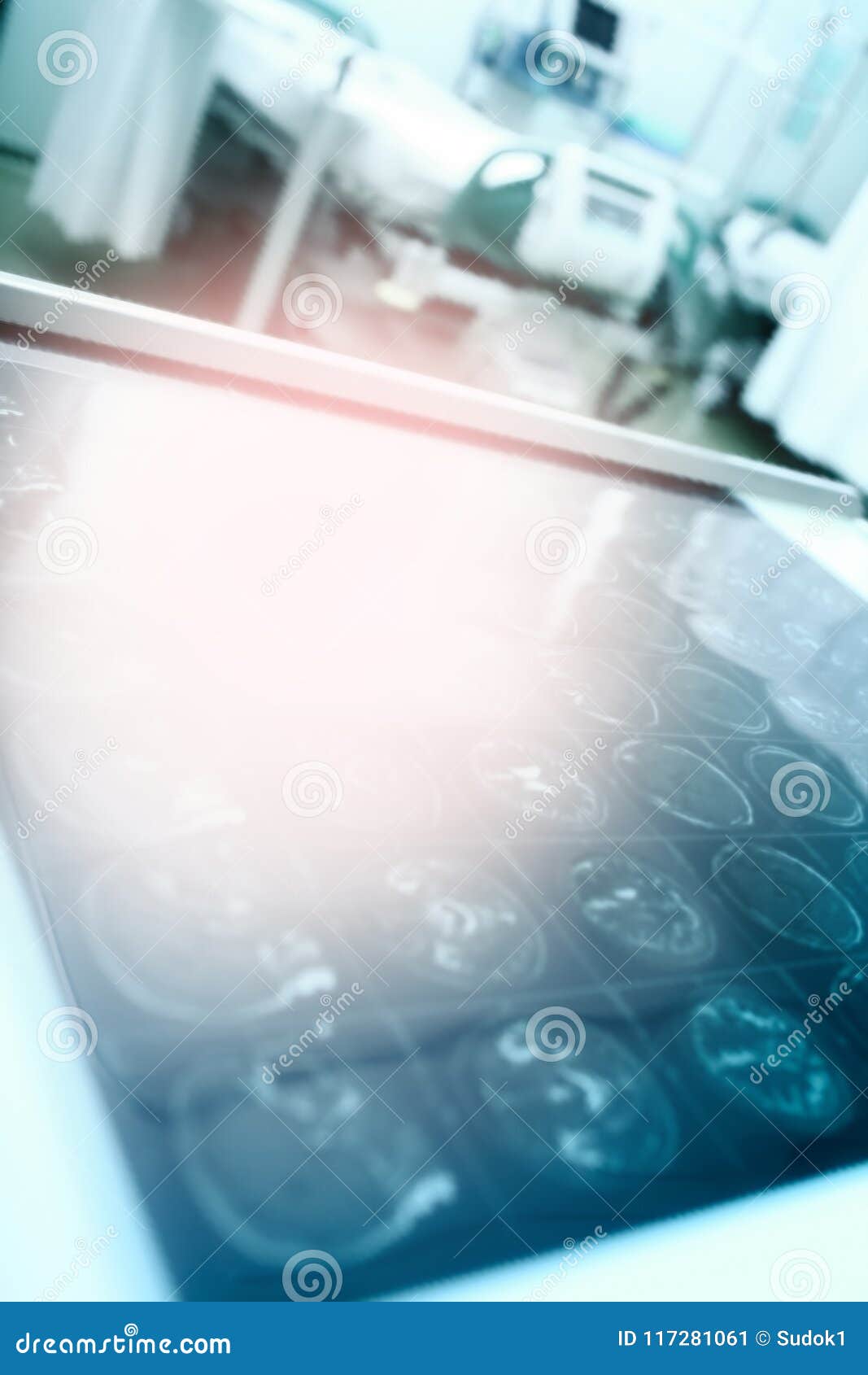 Human Head Scanning Image on the Desktop in Hospital Room Stock Image ...