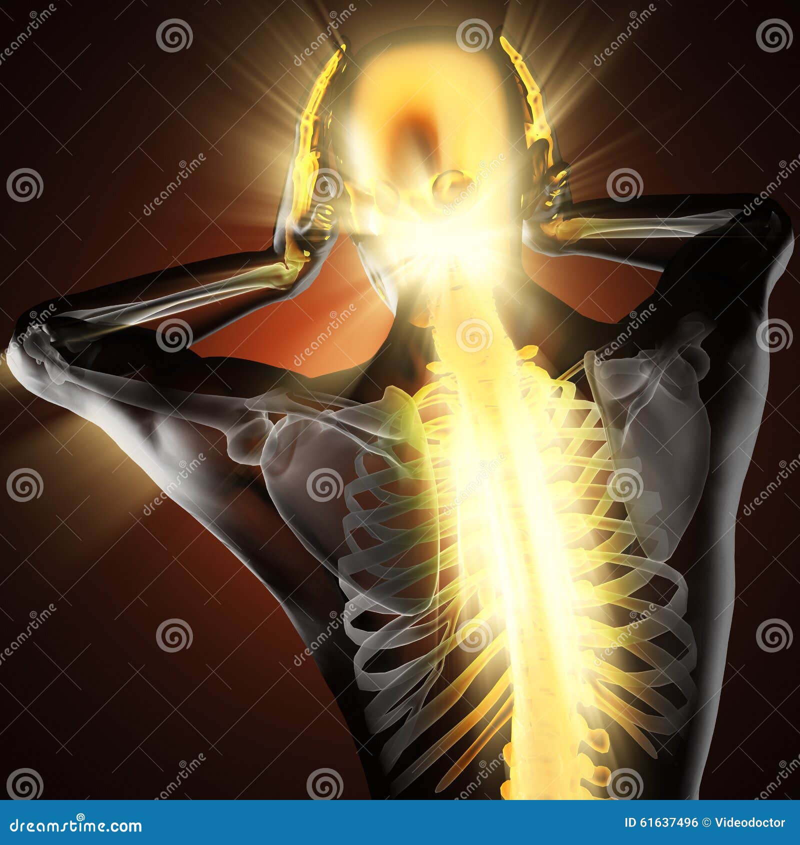 Human with Headache Radiography Scan Stock Photo - Image of injury ...