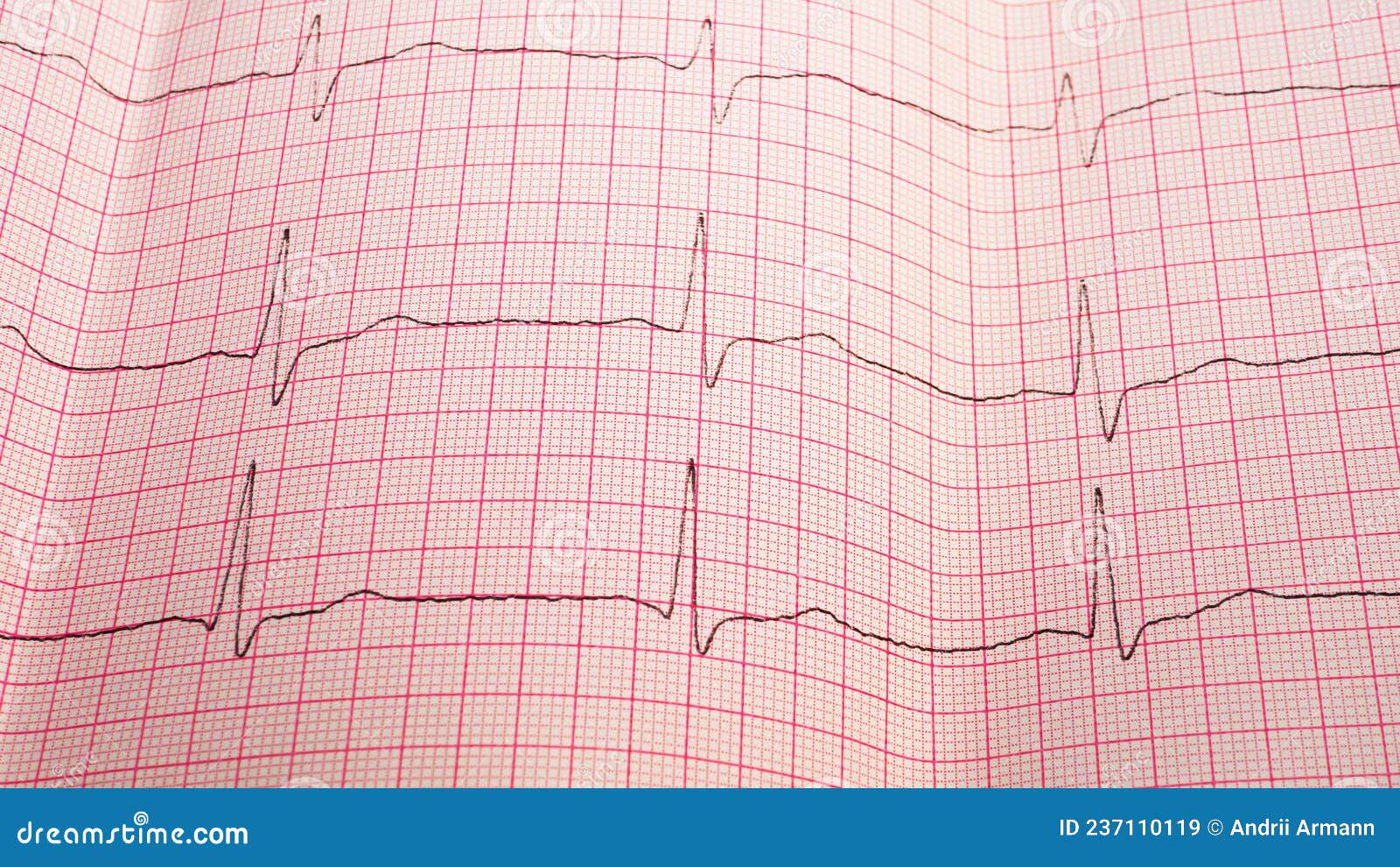 Human Heart Cardiogram Close Up Stock Image - Image of examination ...