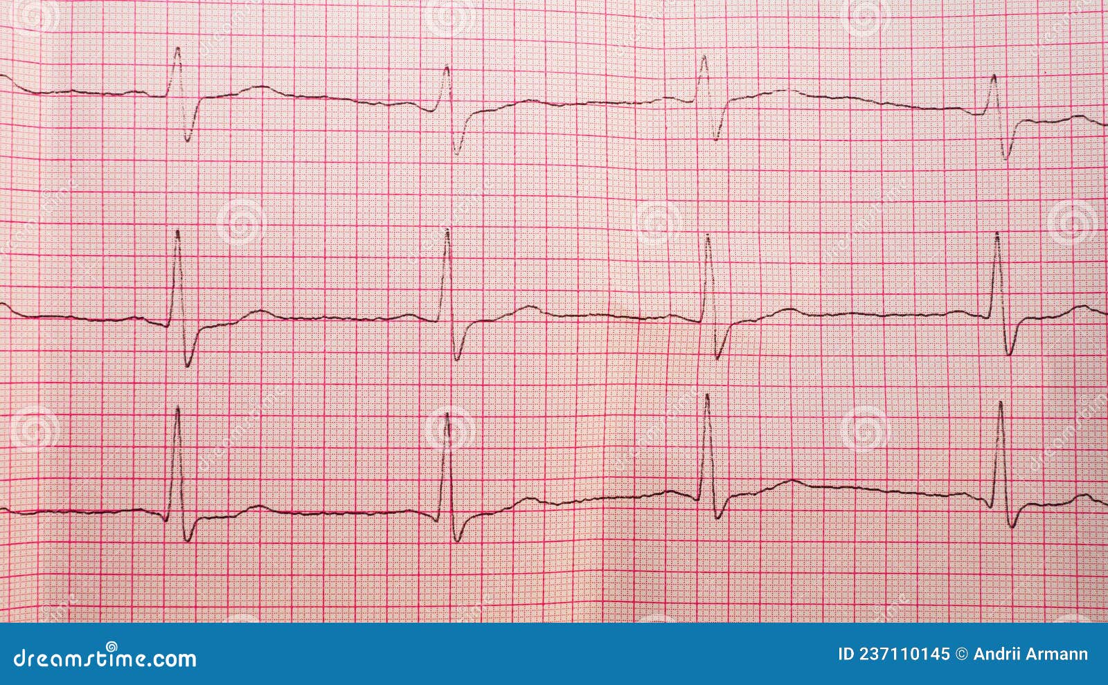 Human Heart Cardiogram Close Up Copy Space Stock Image - Image of gown ...