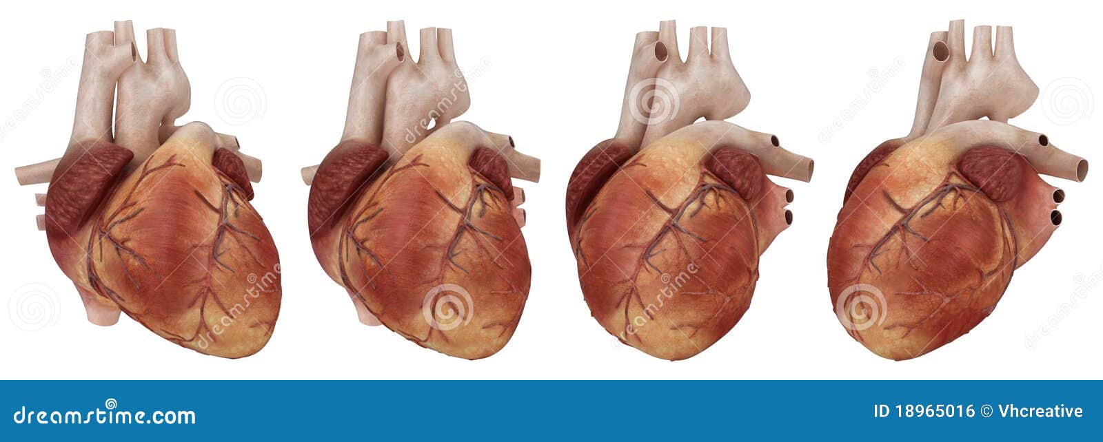 Carditis Clipart And Illustrations