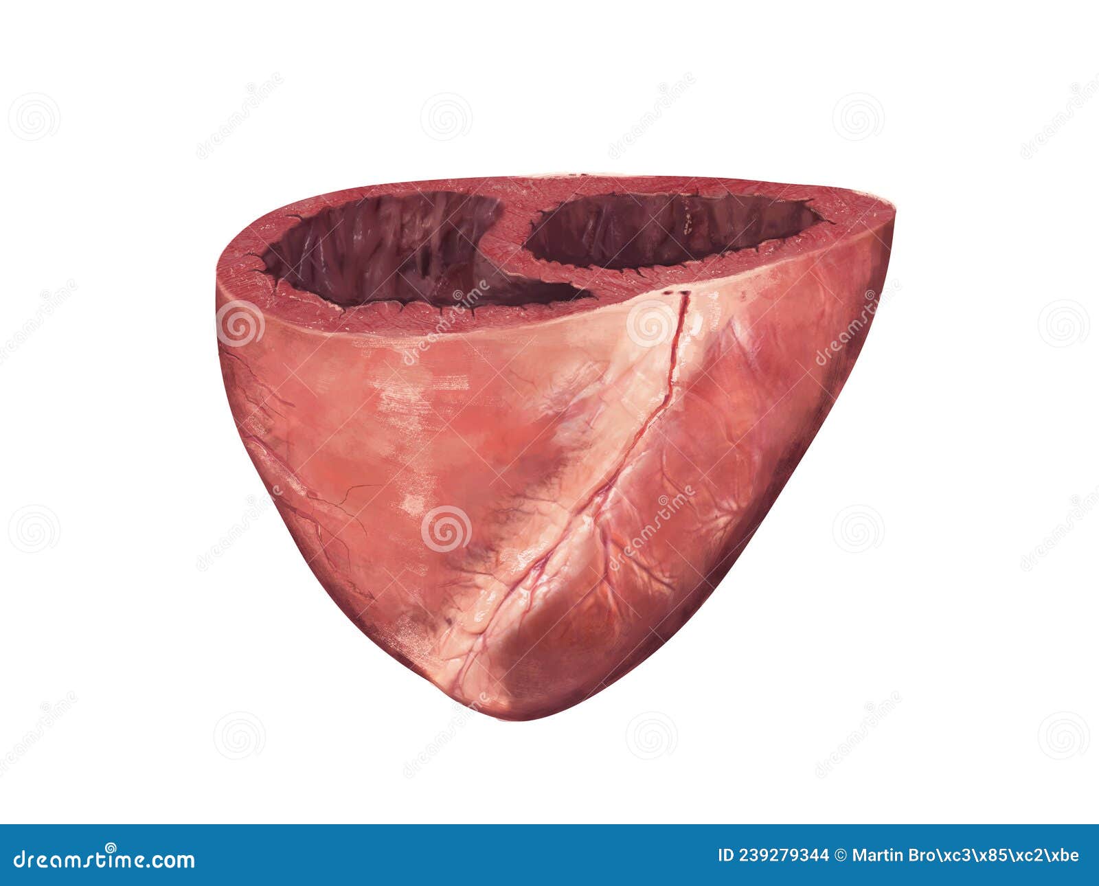 Human Heart, Cross Section, Left and Right Ventricle, Heart Ventricles ...