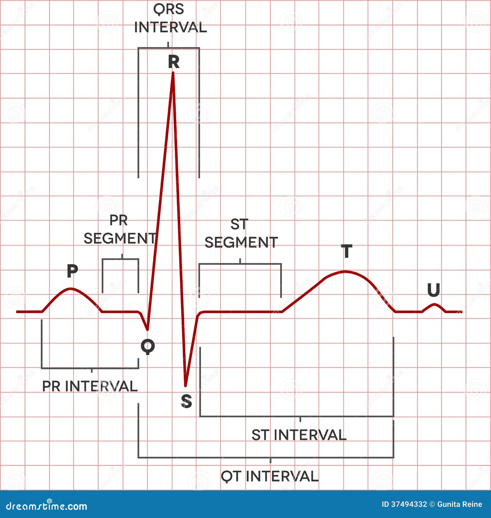 Human Heart Normal Sinus Rhythm, Electrocardiogram Stock Vector ... Human Heart Normal Sinus Rhythm, Electrocardiogram Stock Vector ...