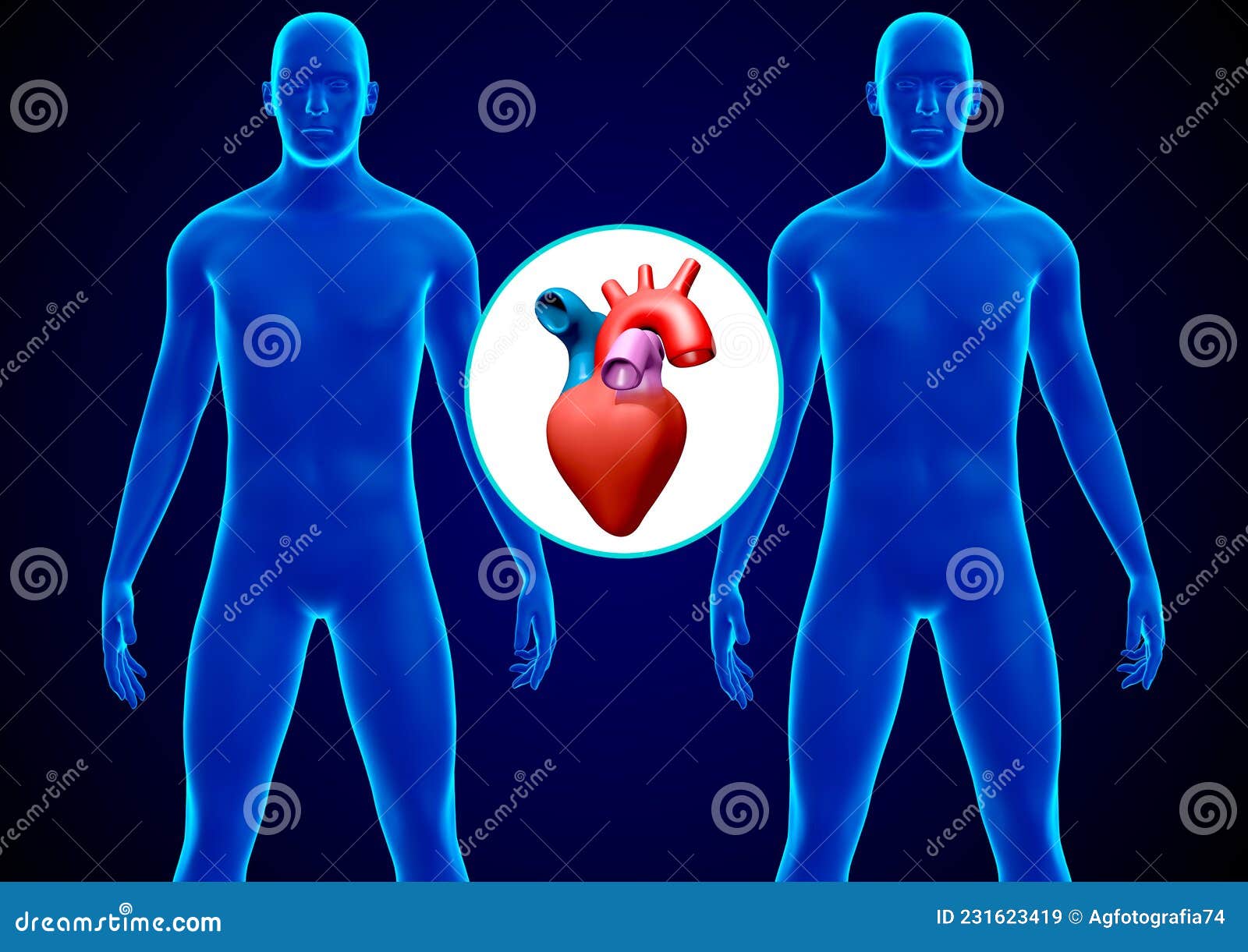 Human Heart Transplant. Replacement of a Sick Heart with a Healthy ...