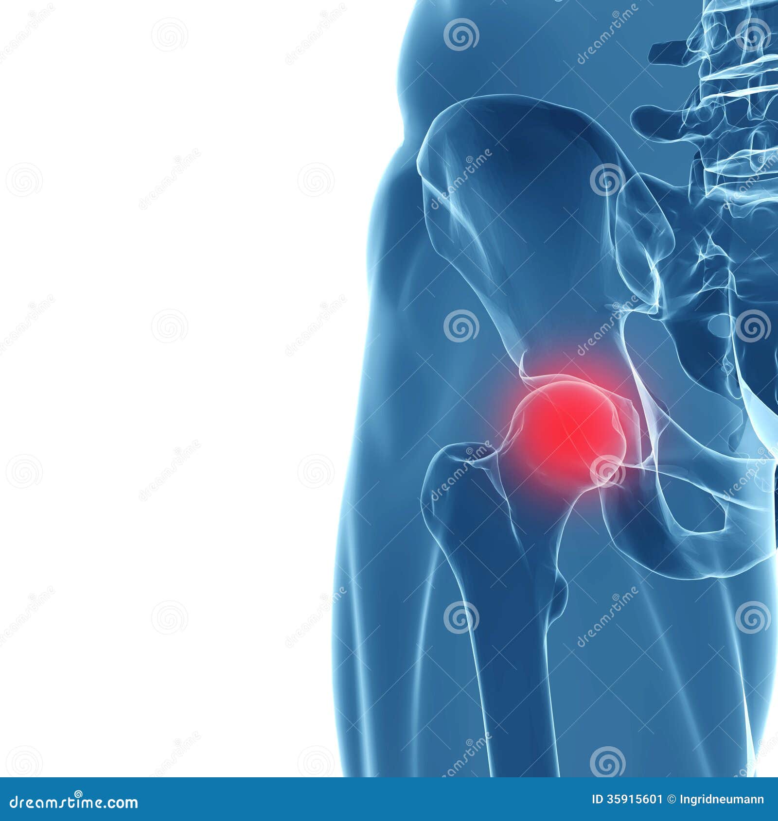 Human Hip Joint, Showing Area of Pain Stock Illustration - Illustration ...