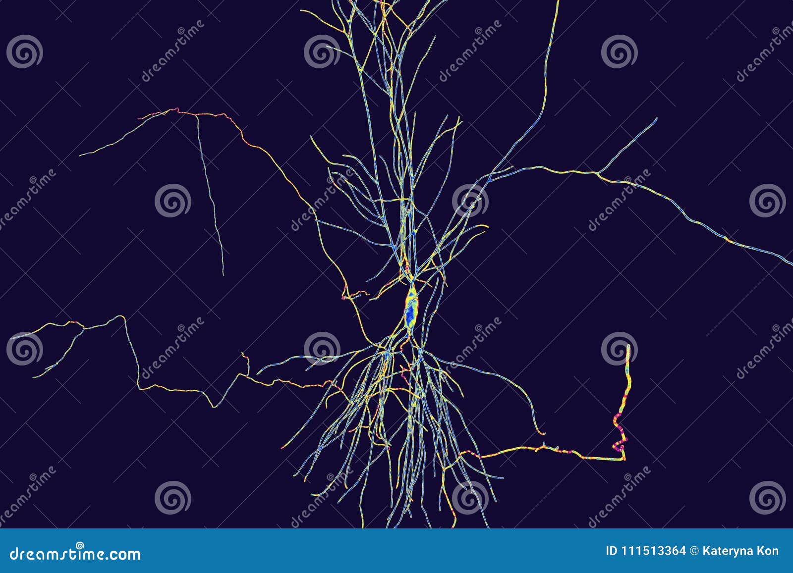 Human Hippocampus Neuron, Computer Reconstruction Royalty-Free ...