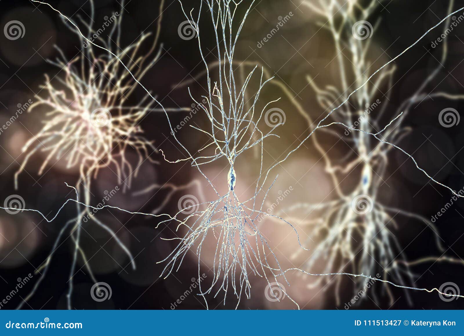 Human Hippocampus Neurons, Computer Reconstruction Stock Image - Image ...
