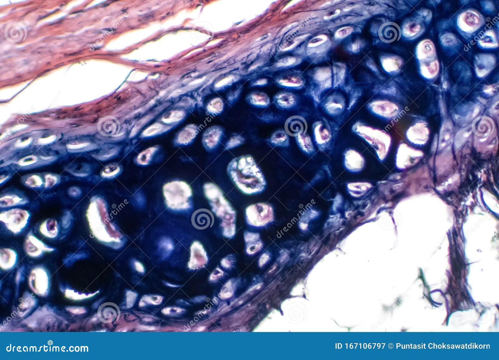 Hyaline Cartilage Under Microscope