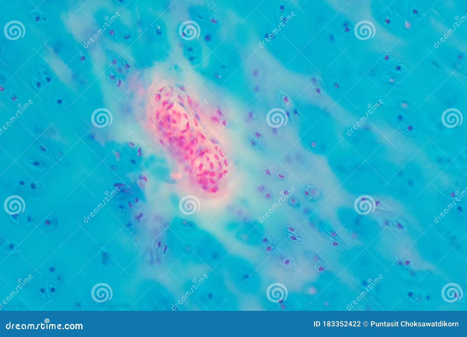 Human Hyaline Cartilage Bone Under Microscope View for Education ...