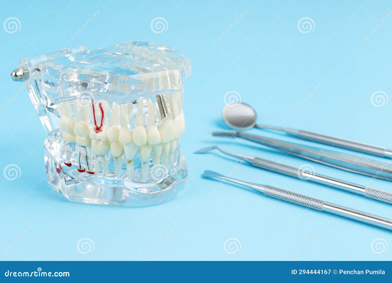 Human Jaw or Acrylic Dentures Model with Implants and Dental Tools ...