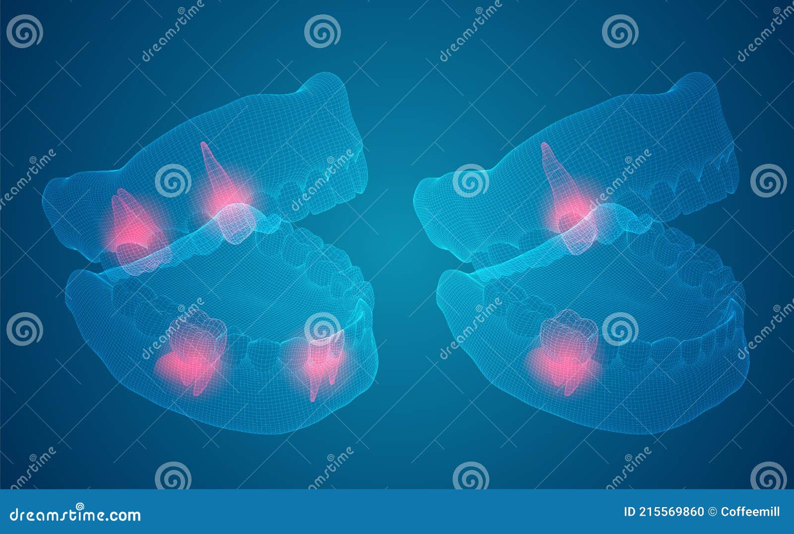 Human Jaw. 3d Vector Layout. Medicine and Health Stock Vector ...