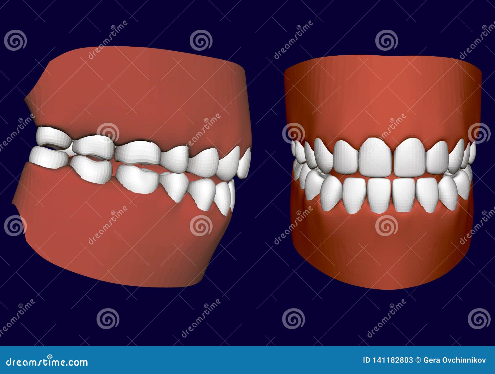 Human Jaw with Teeth. Side and Front View. 3D. Isolated Jaw on a White ...