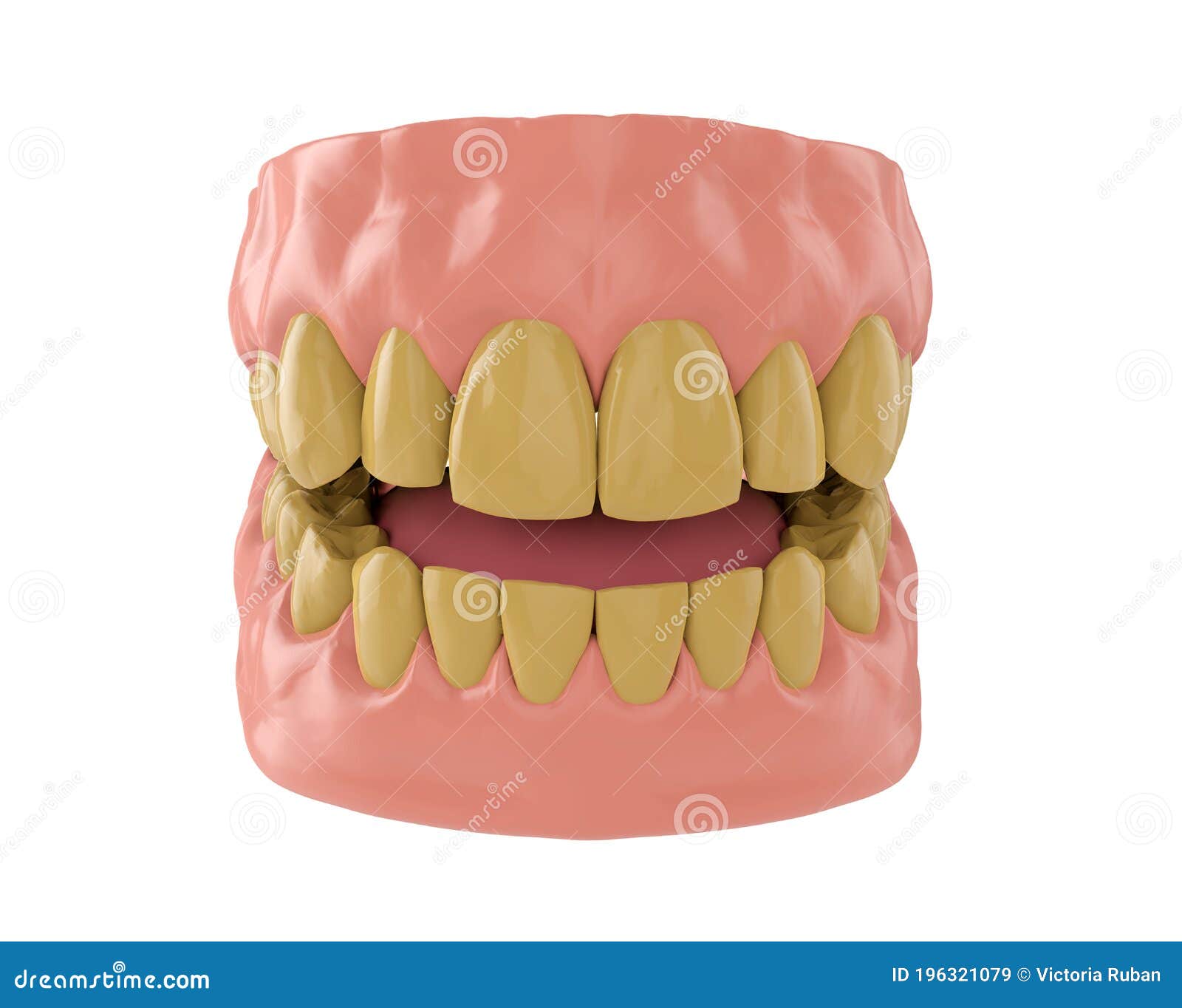 Yellow Teeth Metaphor Unhygienic Oral Royalty-Free Stock Photo ...