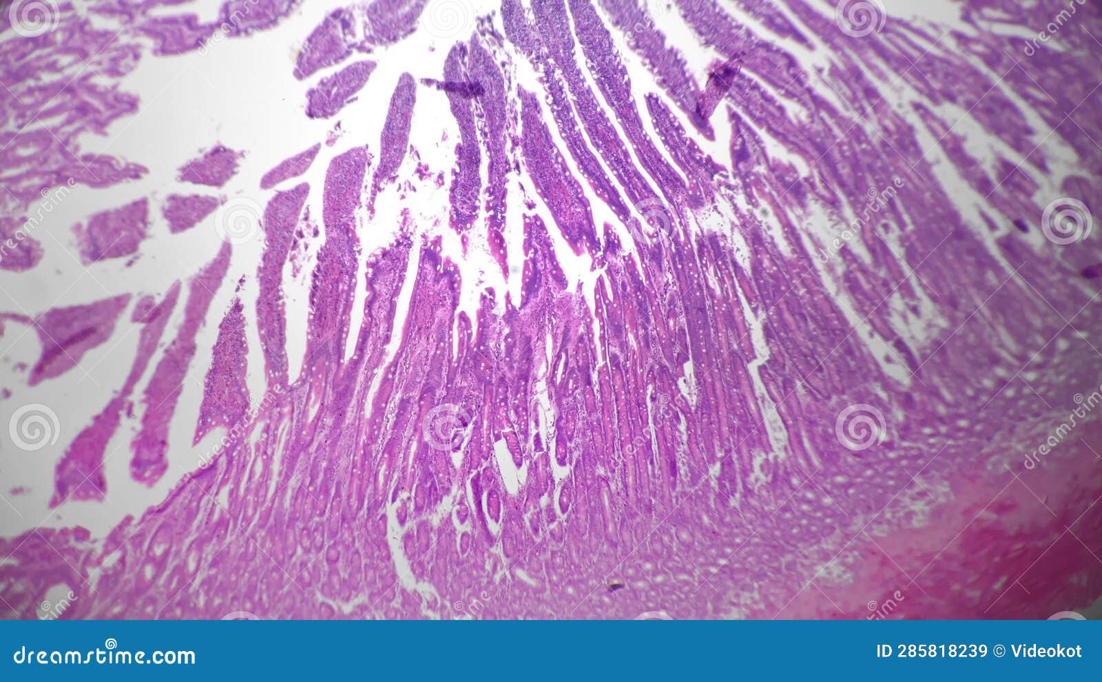 Human Jejunum in Section Filmed Under Scientific Microscope 40x on ...