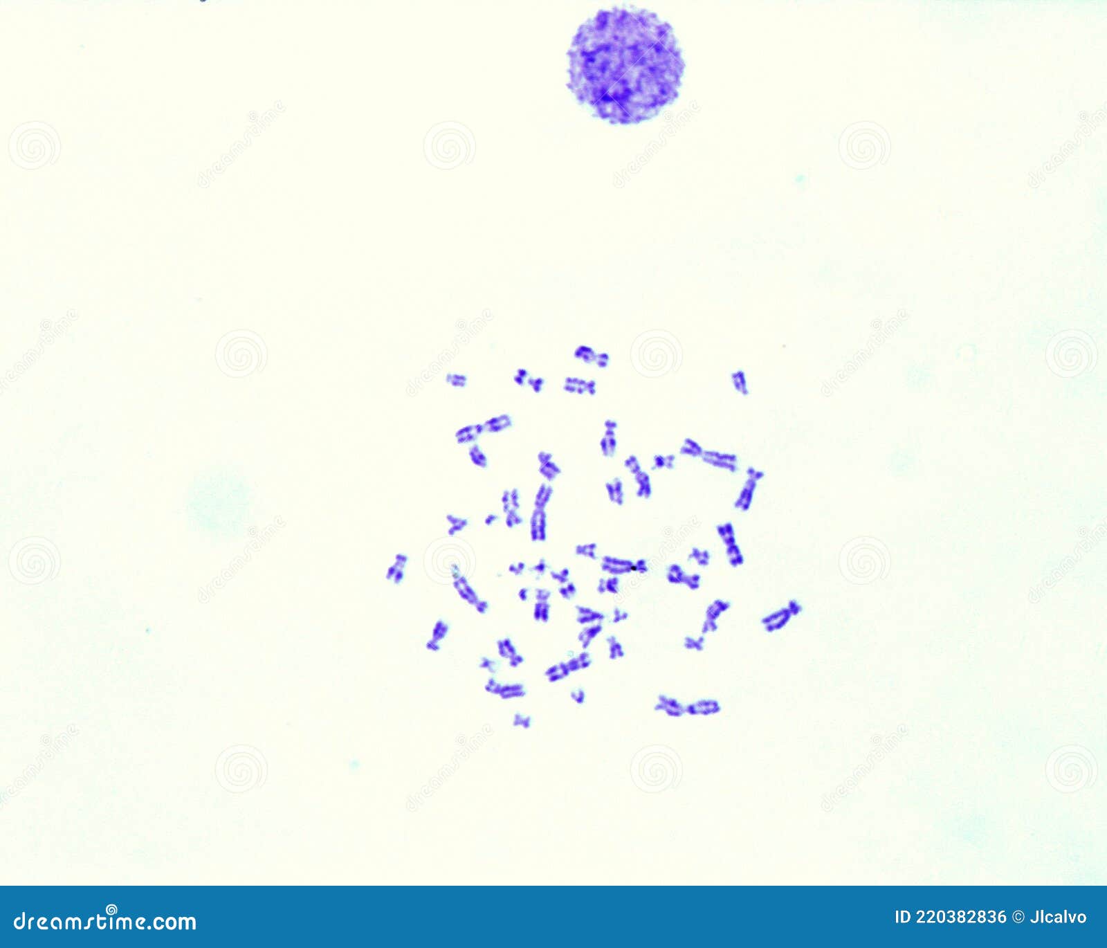 Human karyotype stock photo. Image of micrograph, microscopy - 220382836