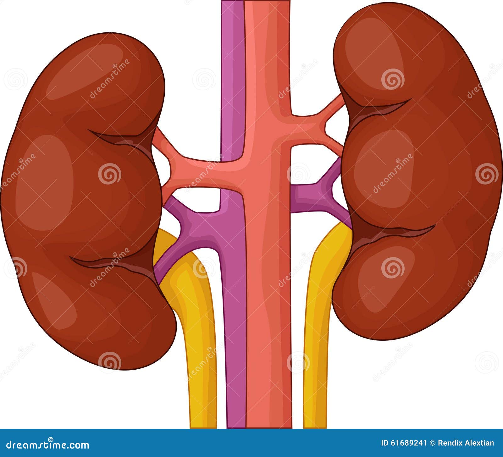 Kidney Cartoon Stones Disease Vector Infographic. Urinary Renal Kidnay ...