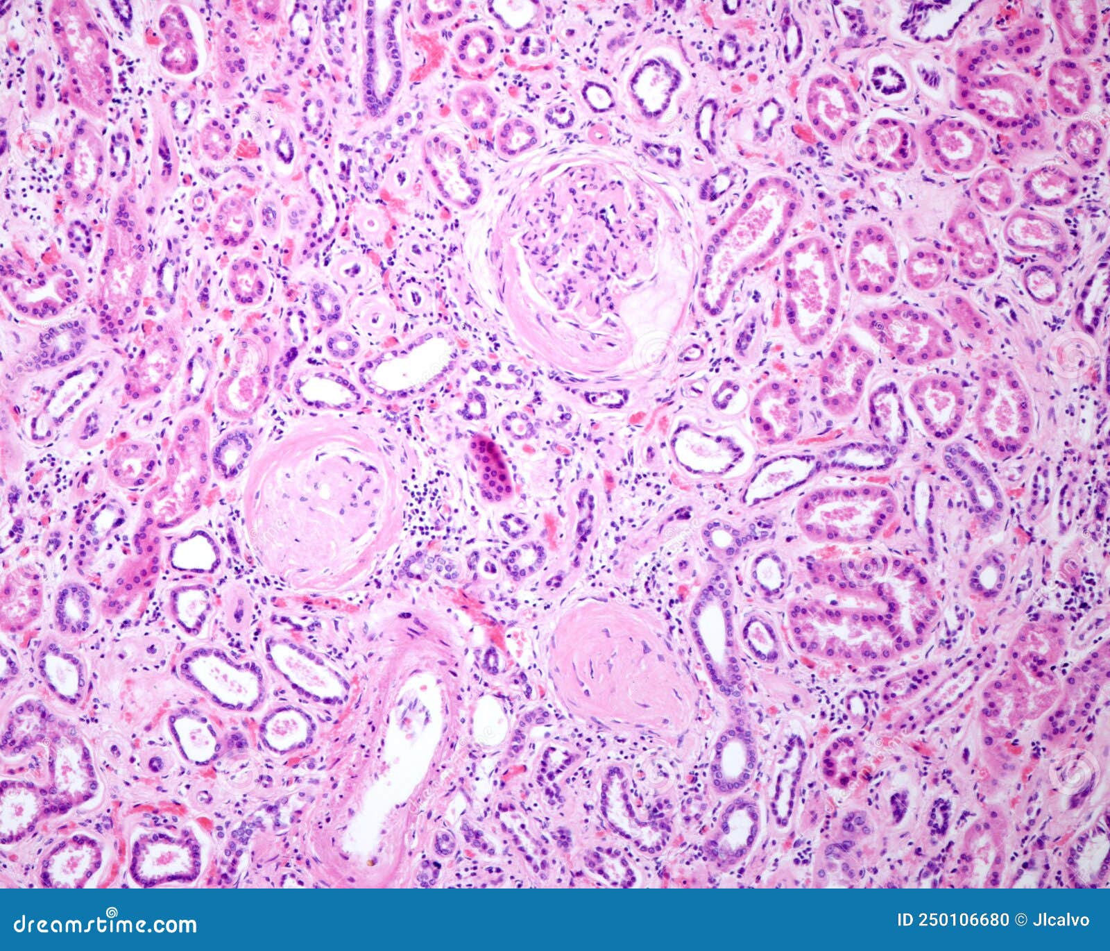 Kidney Glomerulus Micrograph Stock Photography | CartoonDealer.com ...