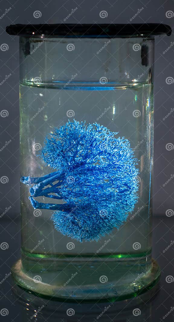 Human Kidney in Formalin Solution Closeup. Stock Photo - Image of renal ...