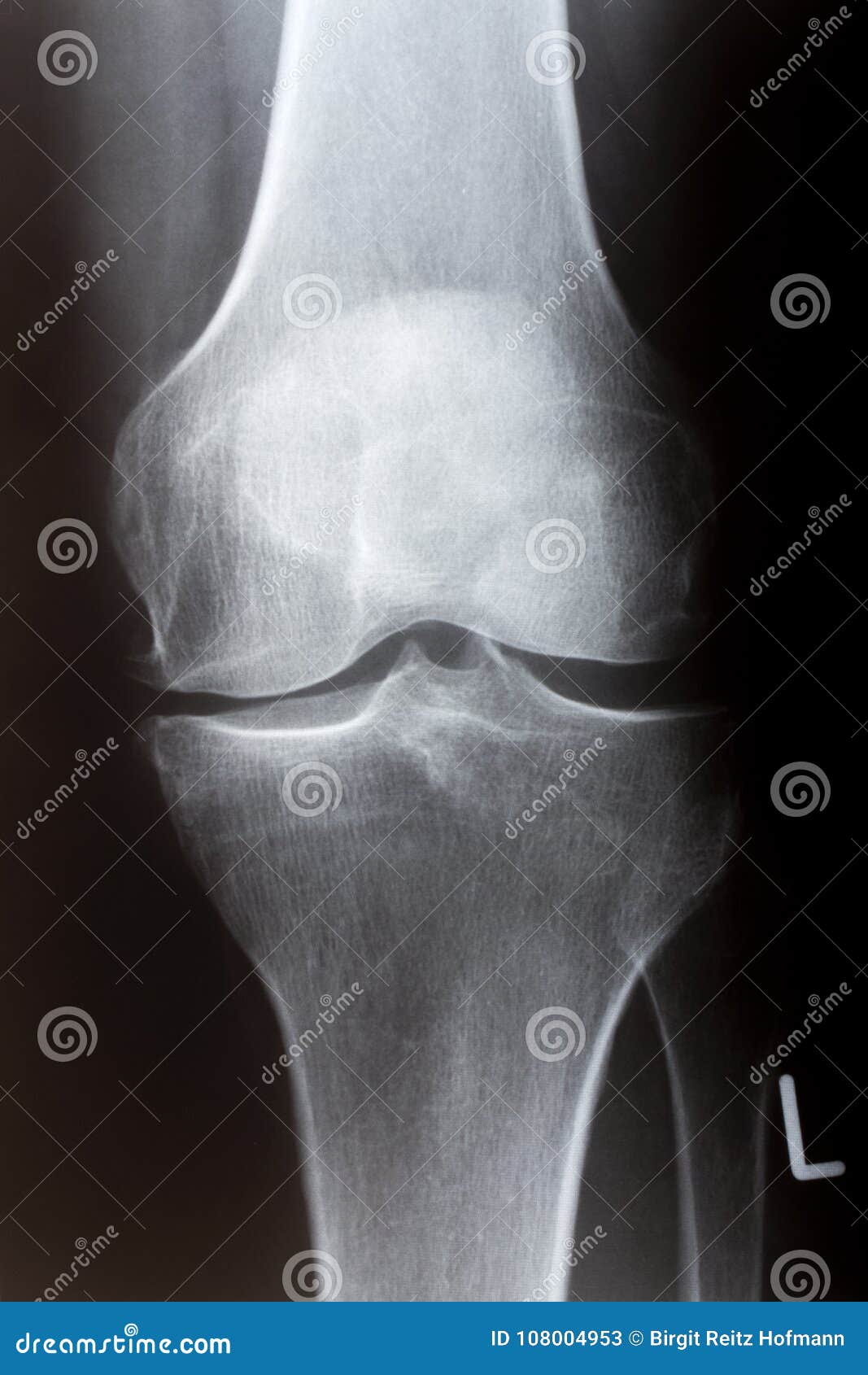 Human knee in front stock image. Image of care, examination - 108004953
