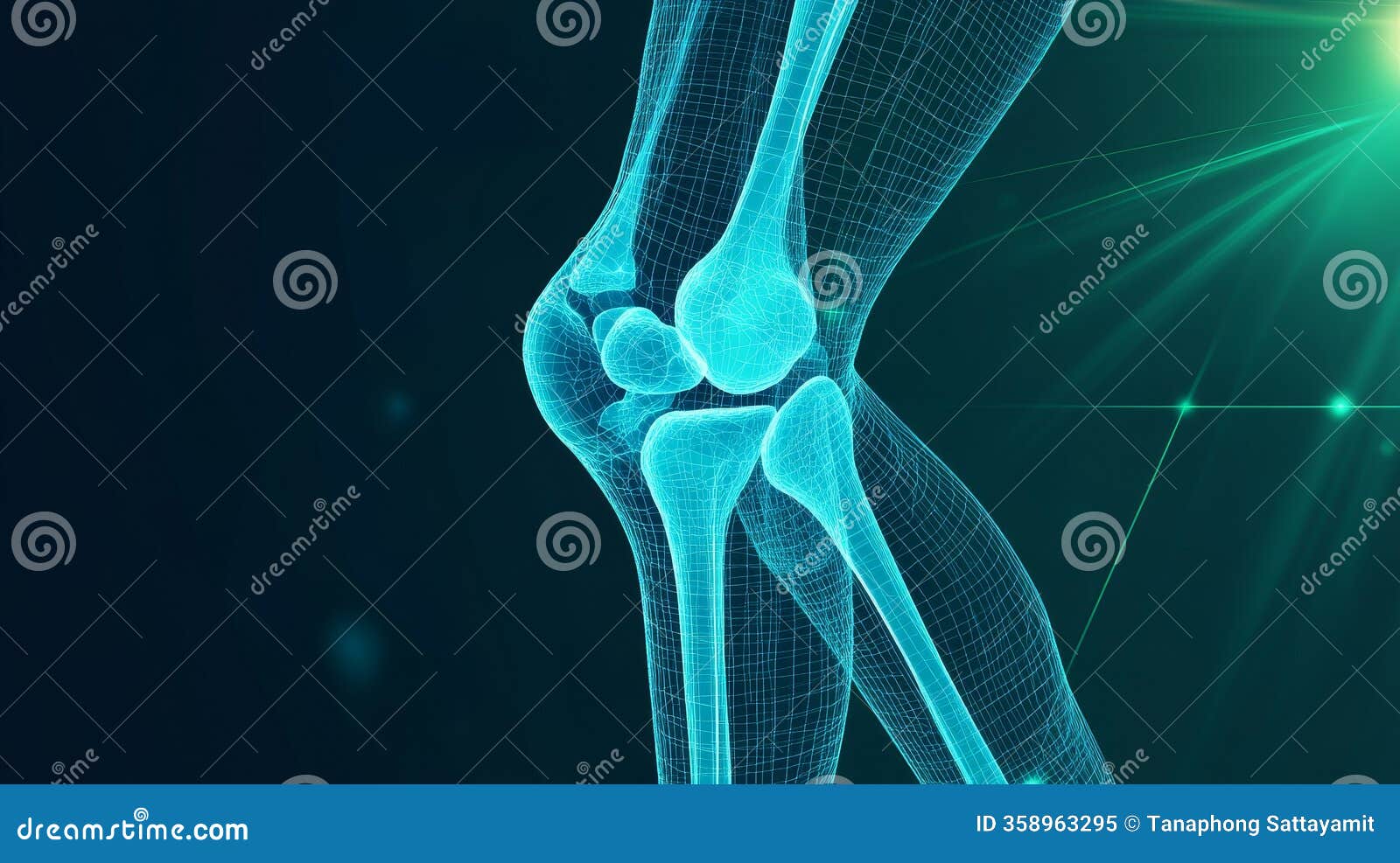 Wireframe Knee Joint Illustration Side View Medical Illustration ...