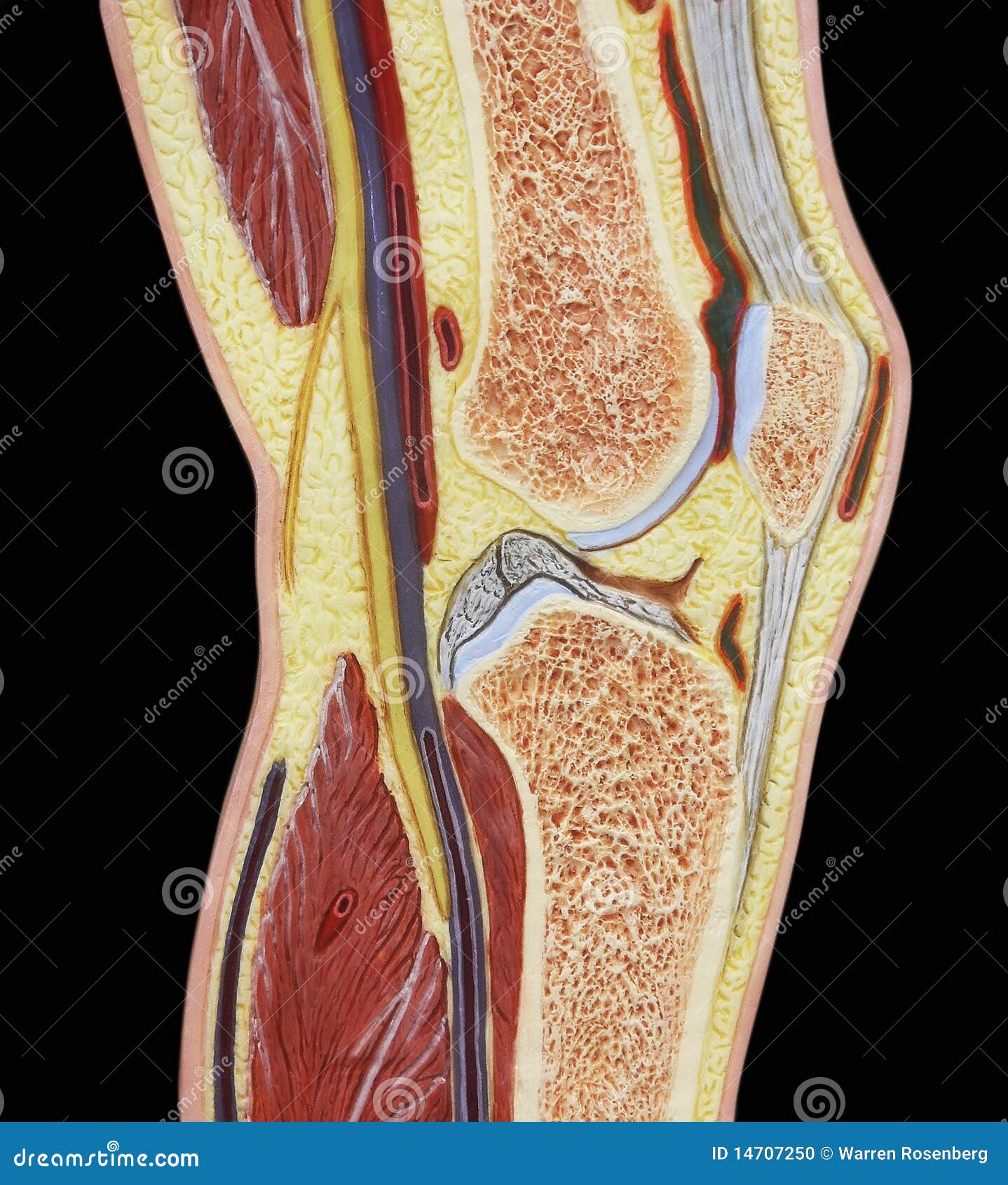 Human Knee Joint Color Silo Stock Photo - Image of knee, ligament: 14707250
