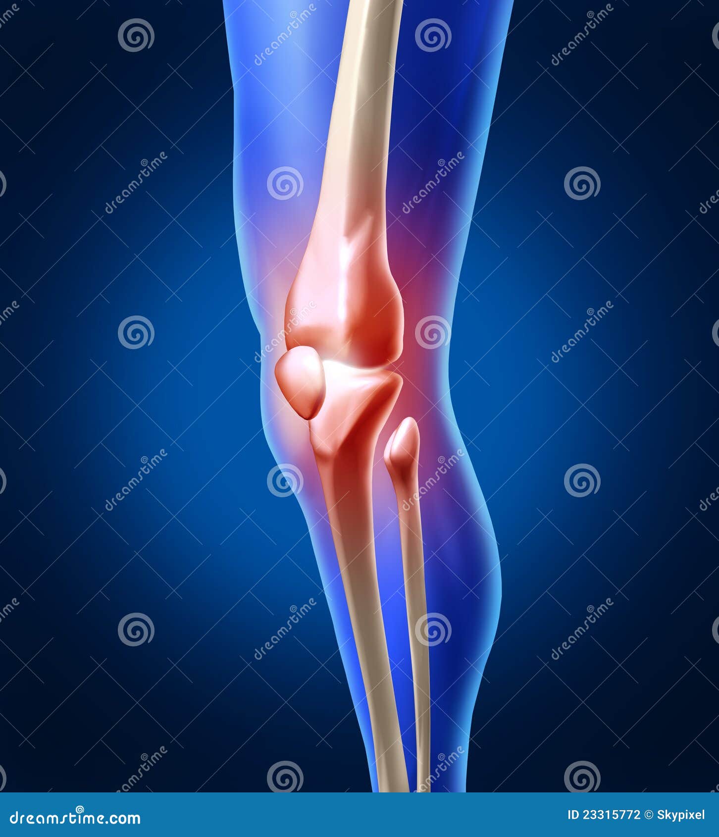 Knee Pain. X-ray Of The Skeleton And Legs. Anatomical Body Of A Seated ...
