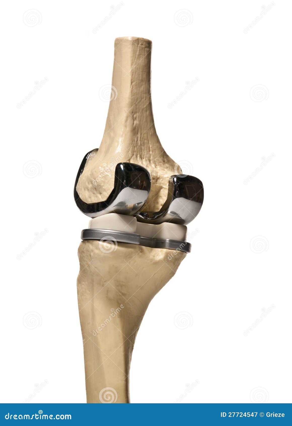 X-ray Of Human Knee Normal Joints And Ligaments Medical Image Concept ...