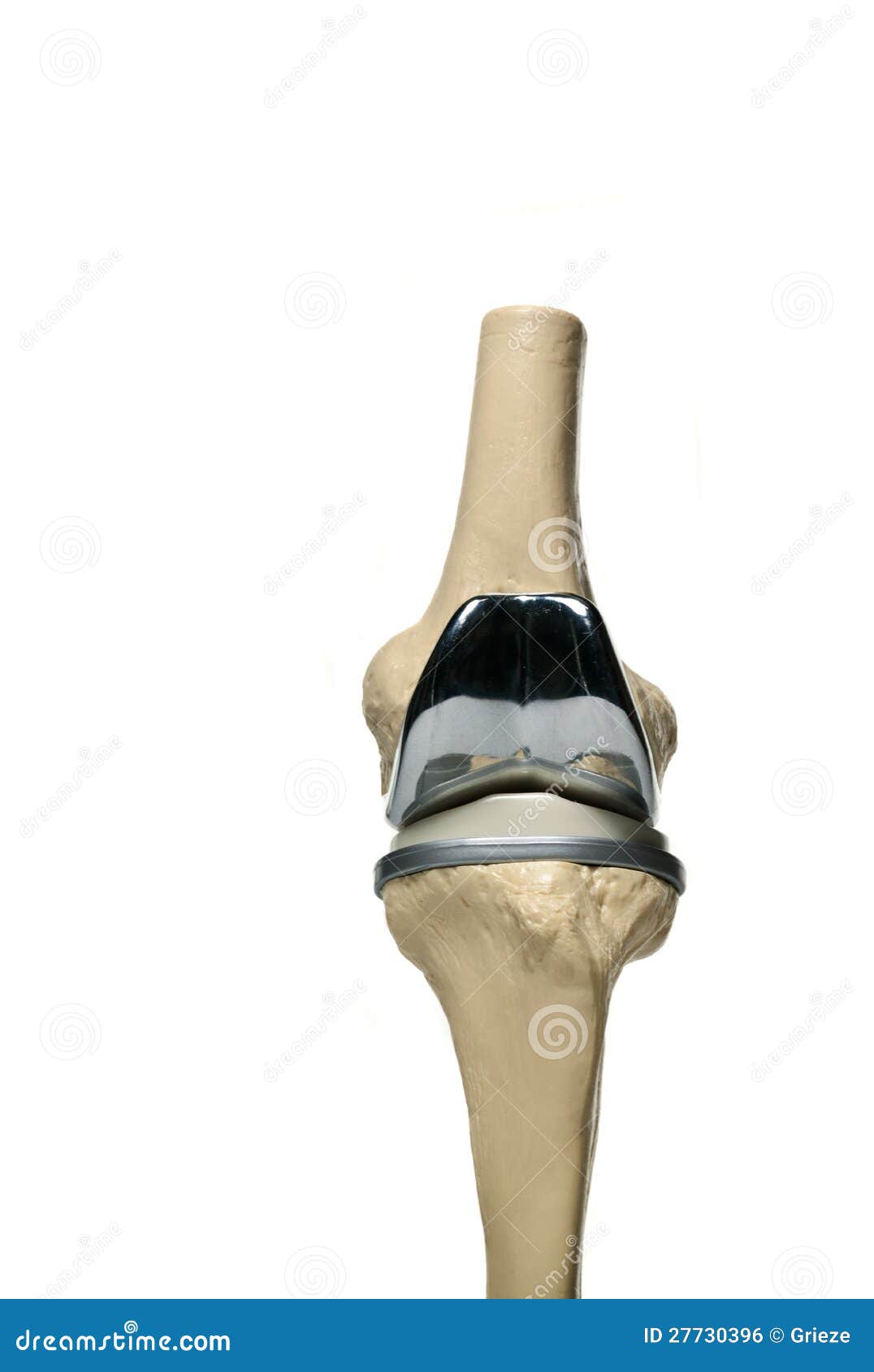 Human Knee Joint Meniscus Model Royalty-Free Stock Photo ...