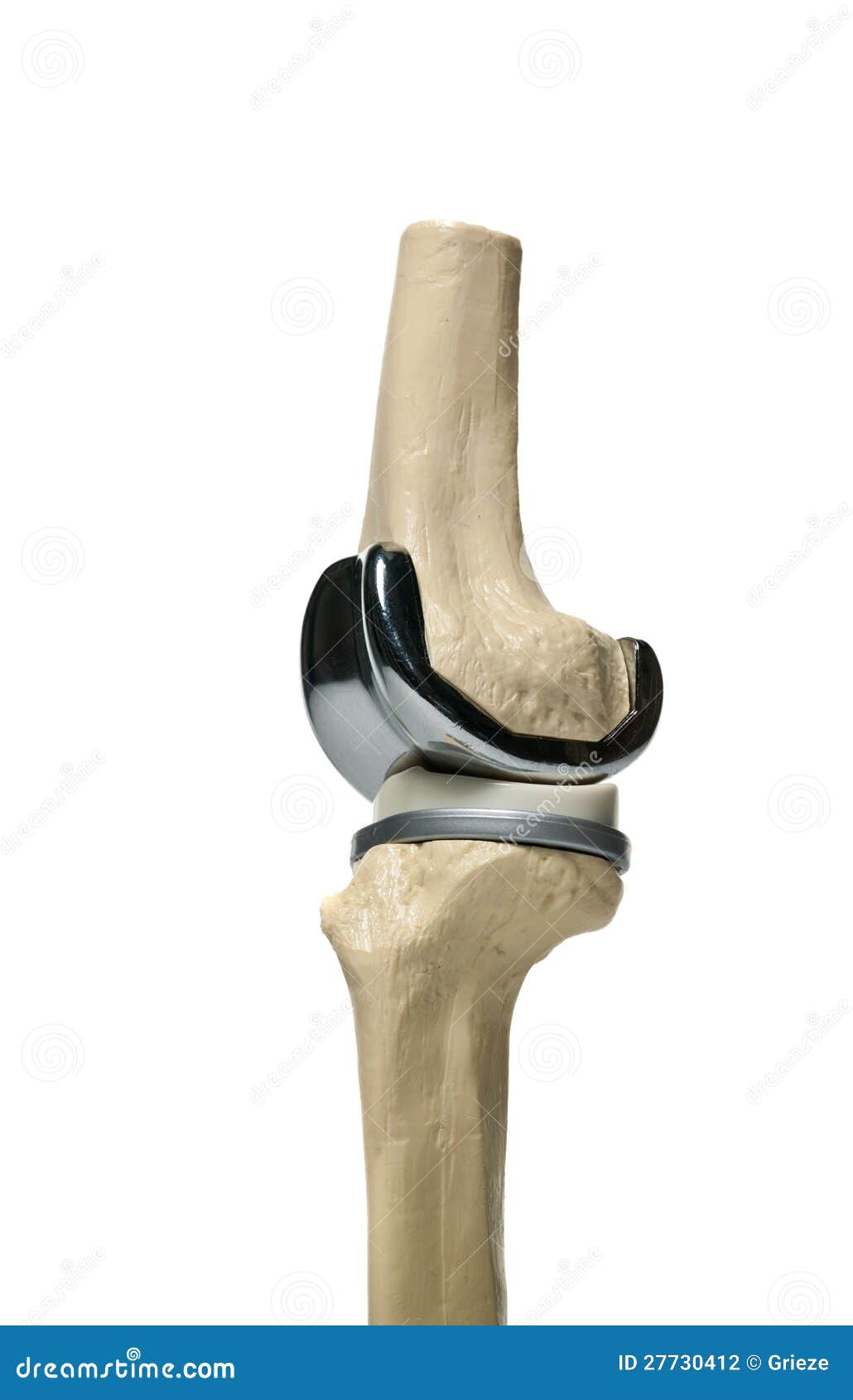 X-ray Of Human Knee Normal Joints And Ligaments Medical Image Concept ...